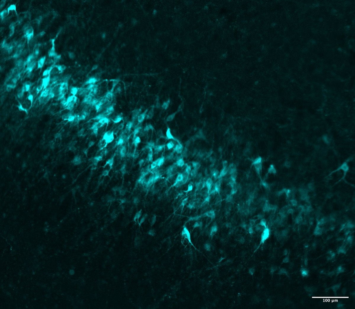 John P. Andrews, MD — Neurosurgery & Research