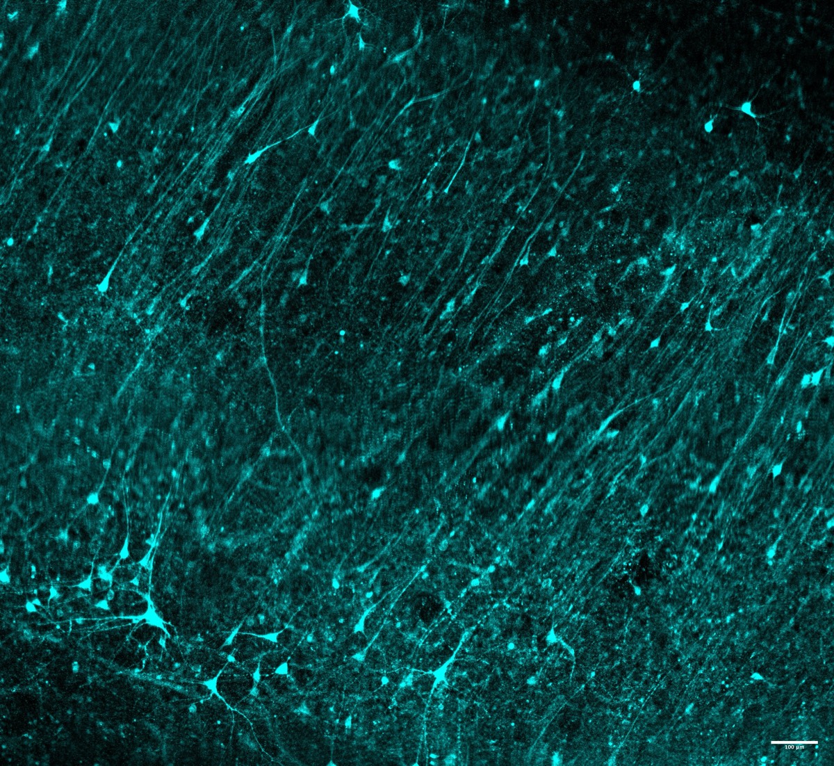 John P. Andrews, MD — Neurosurgery & Research