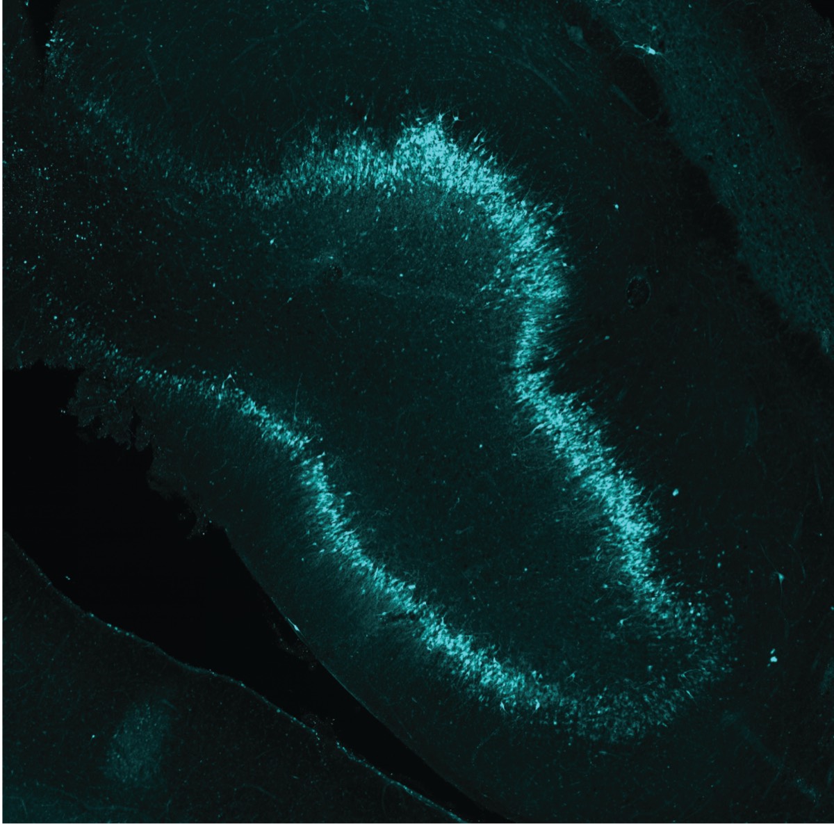 John P. Andrews, MD — Neurosurgery & Research